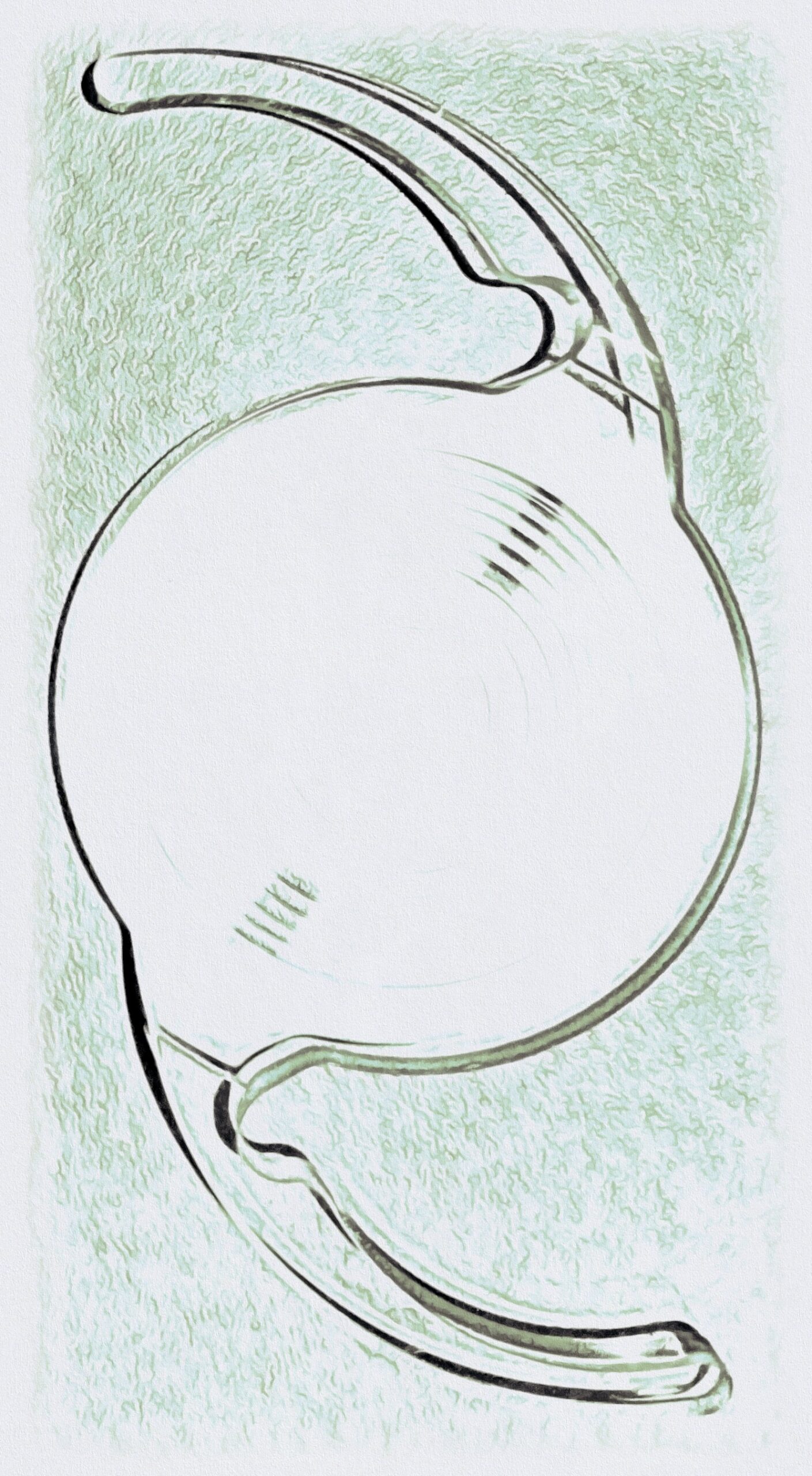 Implant cristallinien torique - Centre d'Ophtalmologie du Dauphine à ...