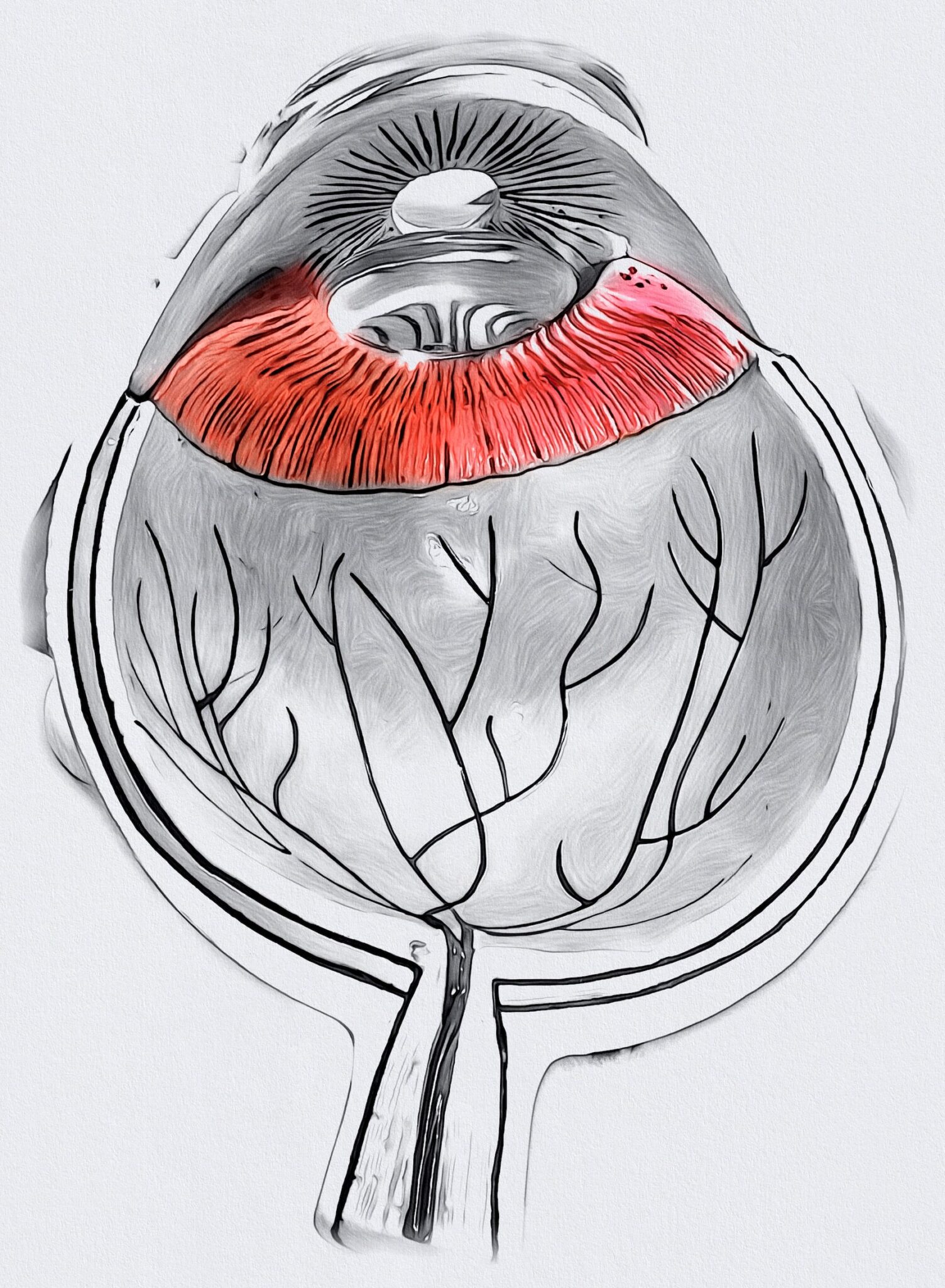 Pars plana - Centre d'Ophtalmologie du Dauphine à Grenoble (38)