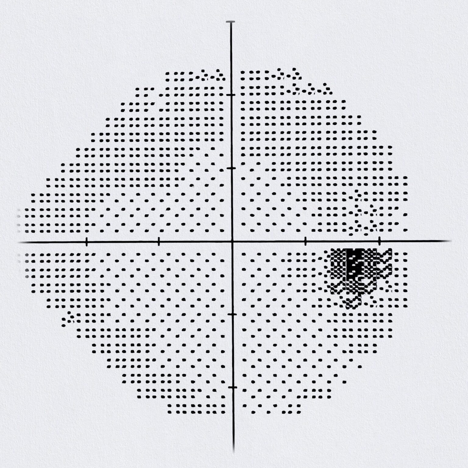Champ visuel - Centre d'Ophtalmologie du Dauphine à Grenoble (38)
