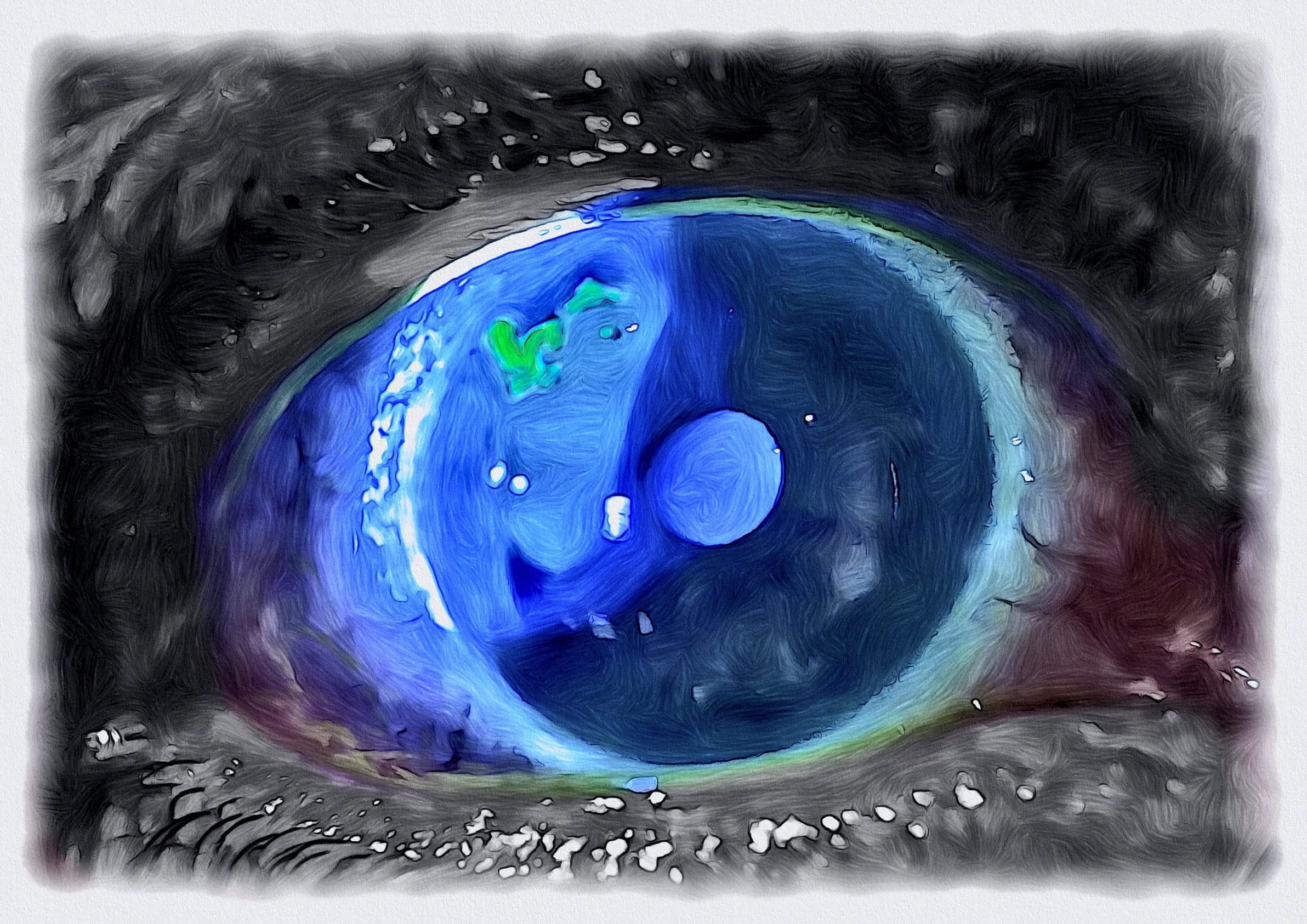 Ulcère de cornée - Centre d'Ophtalmologie du Dauphine à Grenoble (38)